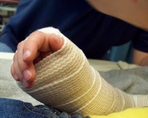 Have You Broken a Bone Recently What to Expect - Spectrum Health