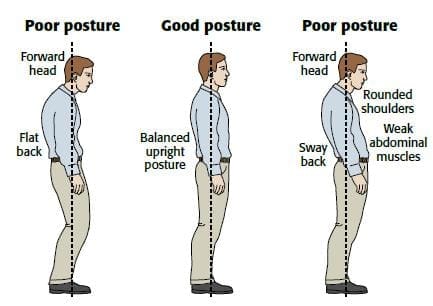 Symptoms, Causes and Treatment of Bad Posture - Spectrum Health